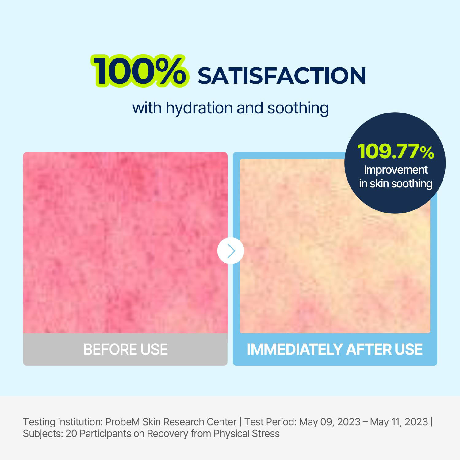 Torriden Dive Low Molecular Hyaluronic Acid Soothing Cream - 100ml ...